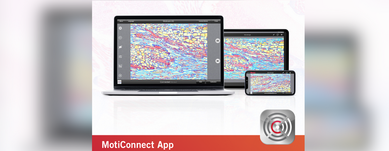 Motic's MotiConnect App - Your True WiFi Microscope Learning Platform – Motic Microscopes